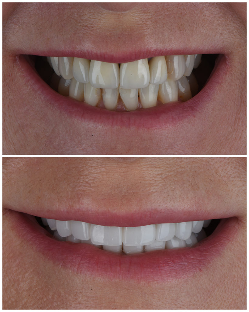 Before & After Gallery | Sharp Dentistry & Associates