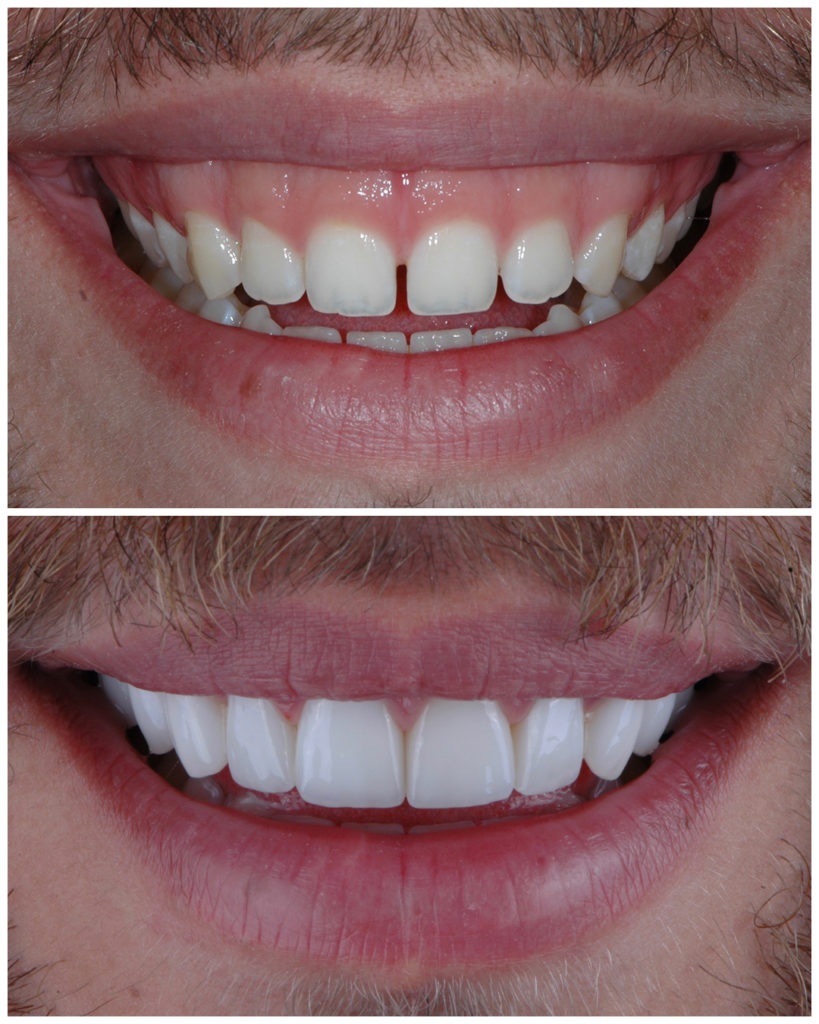 Before & After Gallery | Sharp Dentistry & Associates