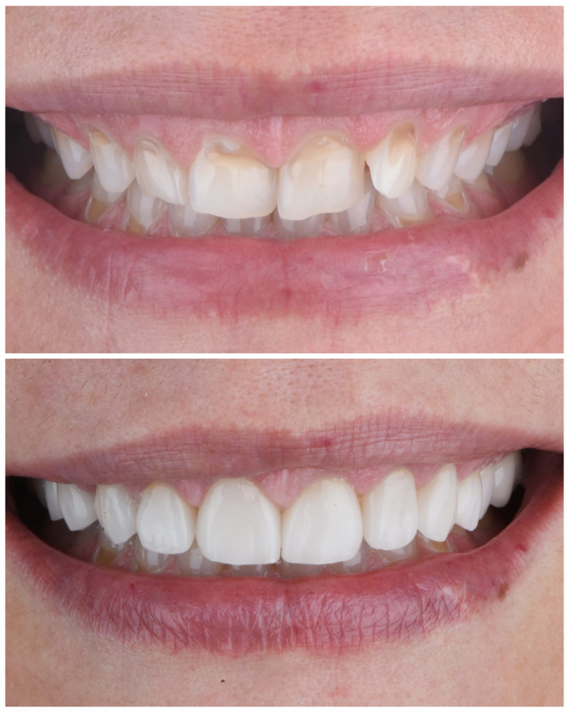 Before & After Gallery | Sharp Dentistry & Associates