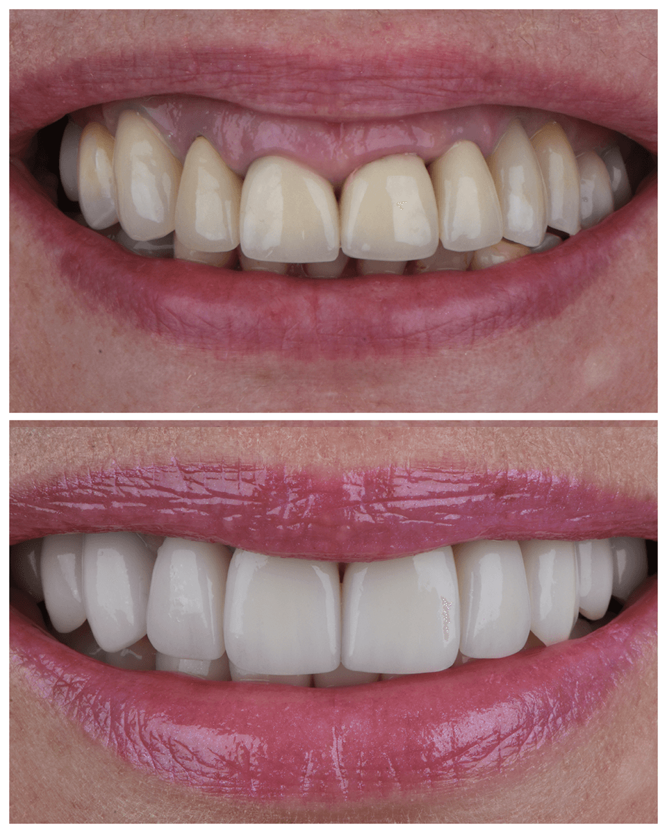 Before & After Gallery | Sharp Dentistry & Associates