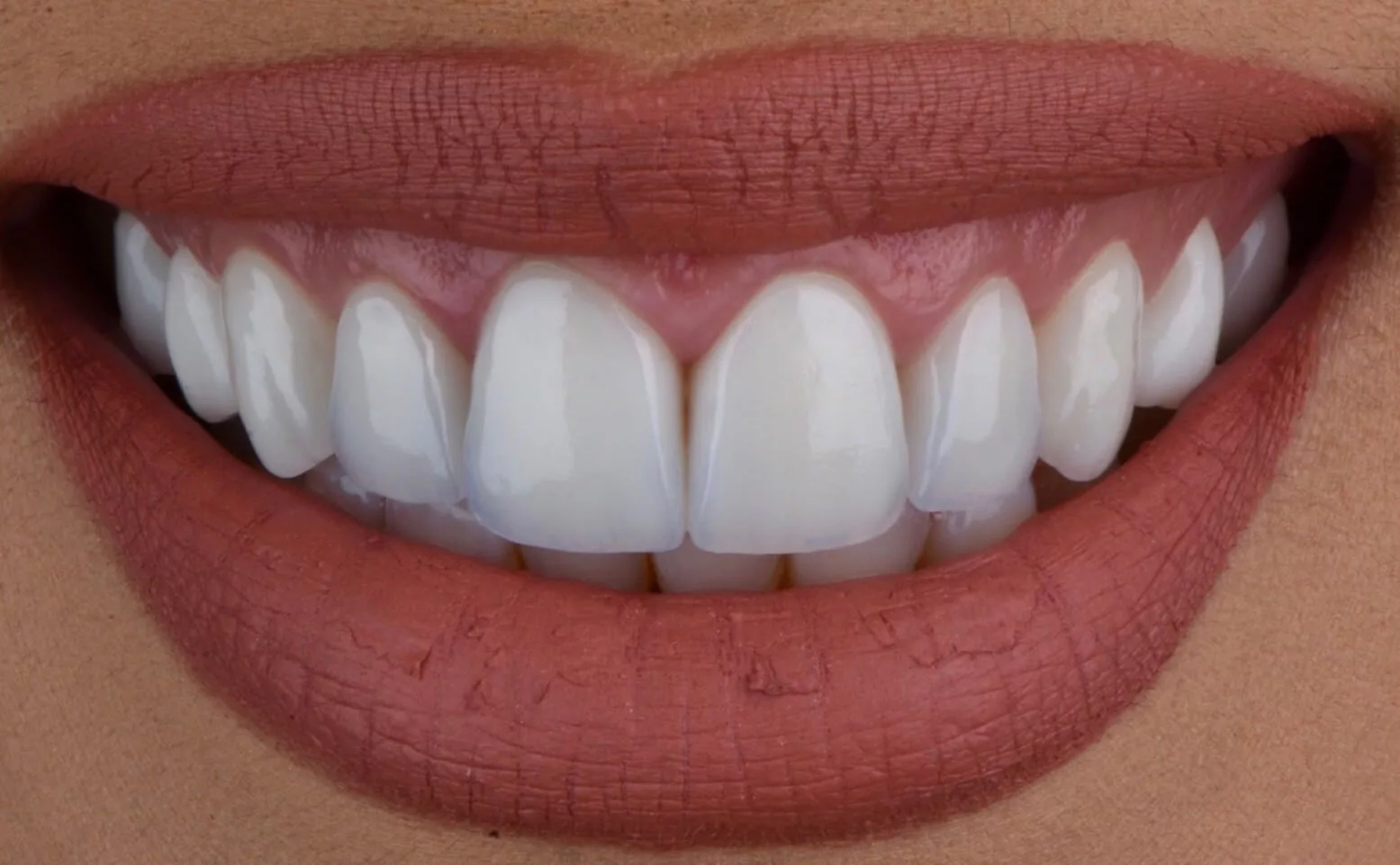 Before & After Gallery | Sharp Dentistry & Associates