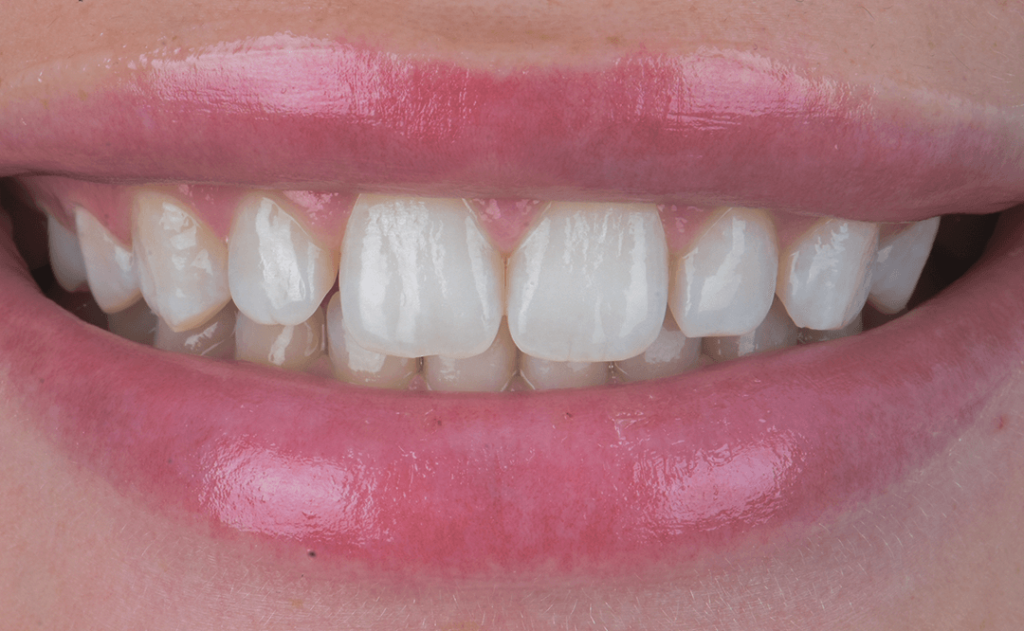 Before & After Gallery | Sharp Dentistry & Associates
