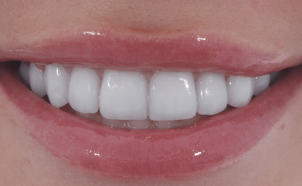 Before & After Gallery | Sharp Dentistry & Associates